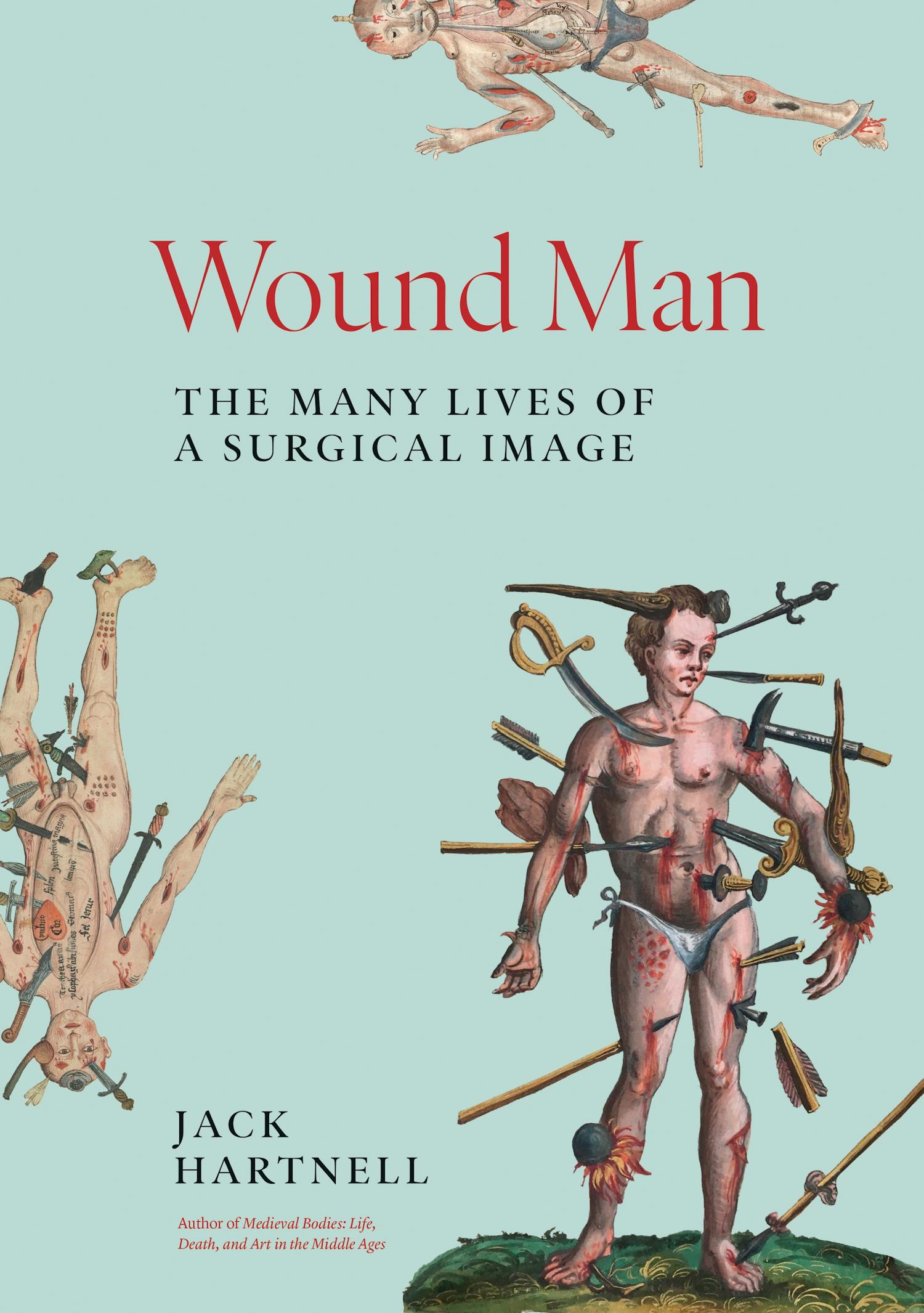 Wound Man | Princeton University Press