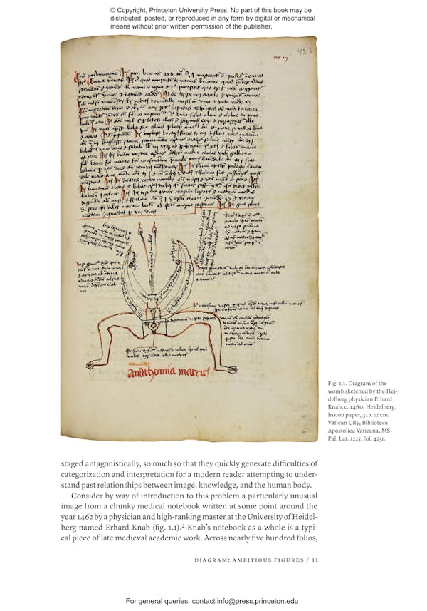 Wound Man | Princeton University Press